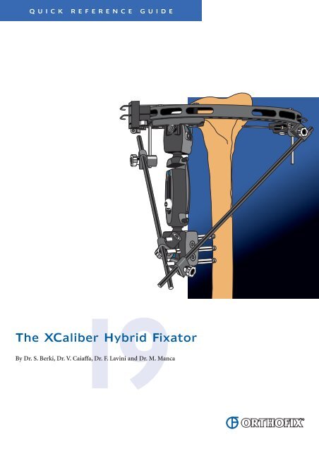The XCaliber Hybrid Fixator - Orthofix.com