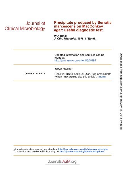 Serratia Marcescens On Macconkey Agar