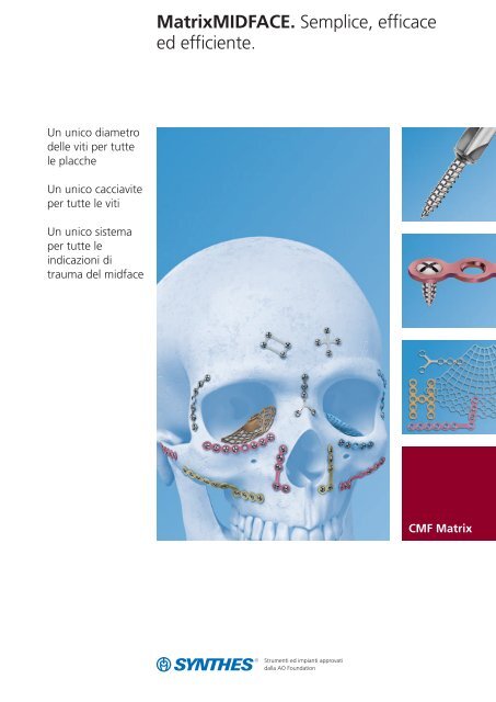 matrixmidface. brossura - Synthes