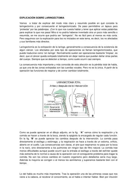 EXPLICACIÓN SOBRE LARINGECTOMIA Vamos a ... - Cubamatinal