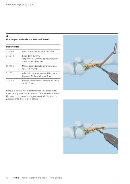 Colocación y fijación d