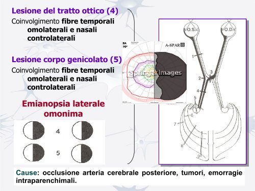 Meno frequente l’emiano