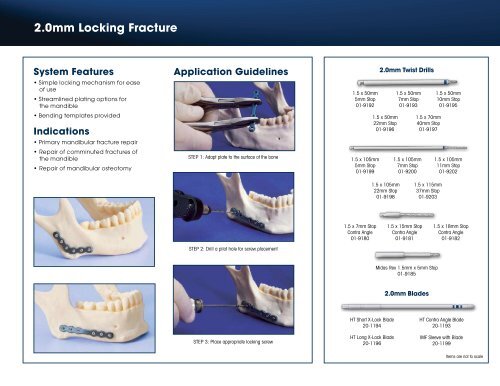 2 0mm Locking Fracture