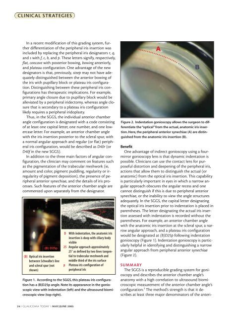 Wide open: All structures