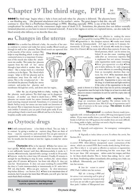 Chapter 19 The third stage, PPH