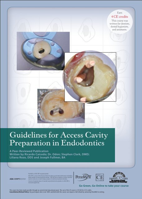 Guidelines for Access Cavity Preparation in Endodontics