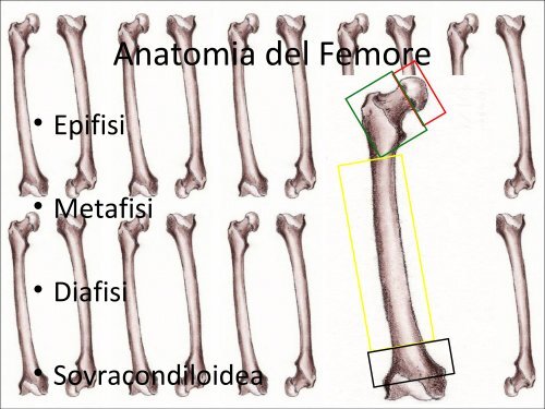 Epifisi • Metafisi