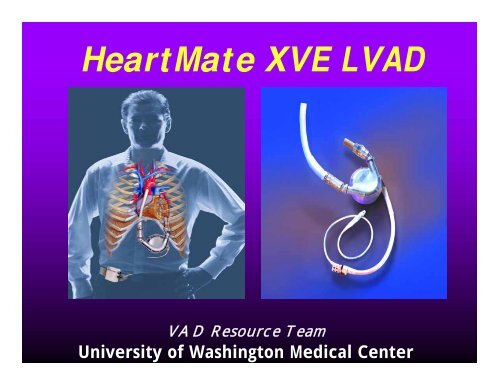 HeartMate XVE LVAD - Snohomish County Fire District 7