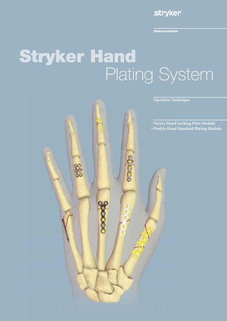 Stryker Hand Plating System
