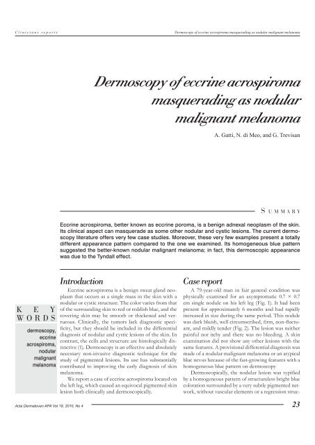 Dermoscopy of eccrine acrospiroma masquerading as nodular ...