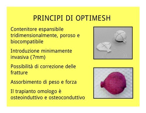 PRINCIPI DI OPTIMESH Cont