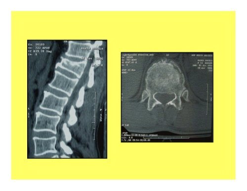 R.L uomo a.55 fratt. T12