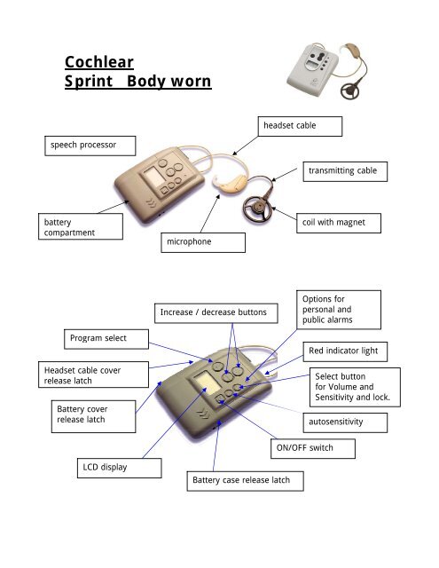 Cochlear Sprint Body worn - Sounding Board