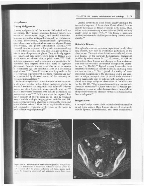 Abdominal Wall The Femor