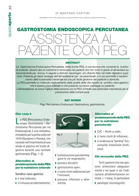ASSISTENZA AL PAZIENTE CON PEG - Ipasvi Perugia