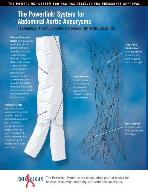 The Powerlink® System for Abdominal Aortic Aneurysms - Endologix