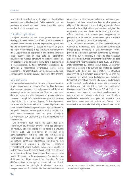 Capillaires en réseau Va