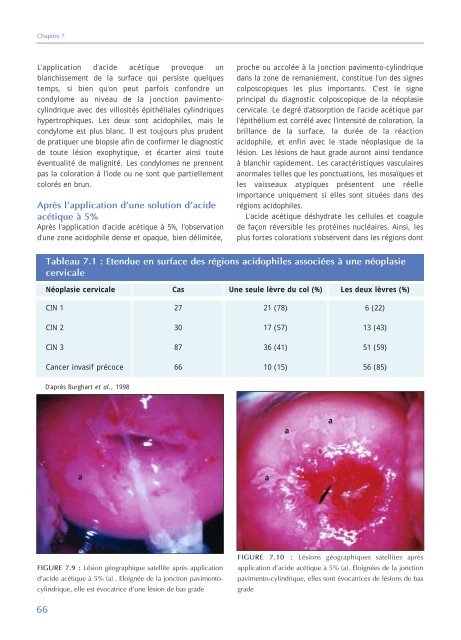 la leucoplasie, il faut f