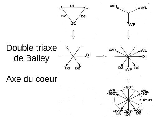 Double triaxe de Bailey A