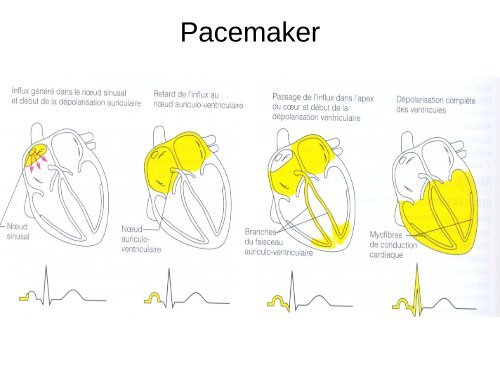 Double triaxe de Bailey A
