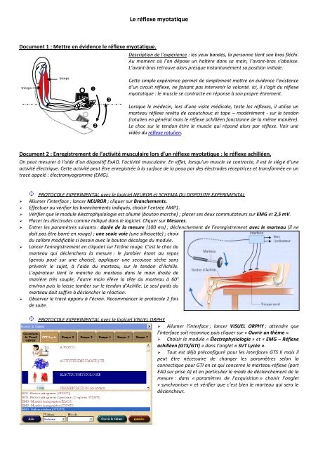 Le réflexe myotatique - SVT au lycée Louis Armand
