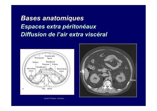 Bases anatomiques Espaces