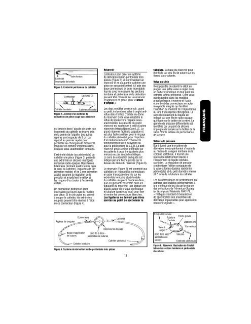 Systèmes de dérivation