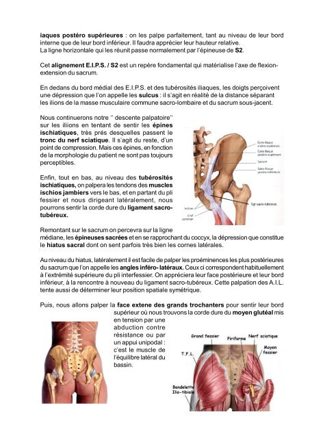 iaques postéro supérieu