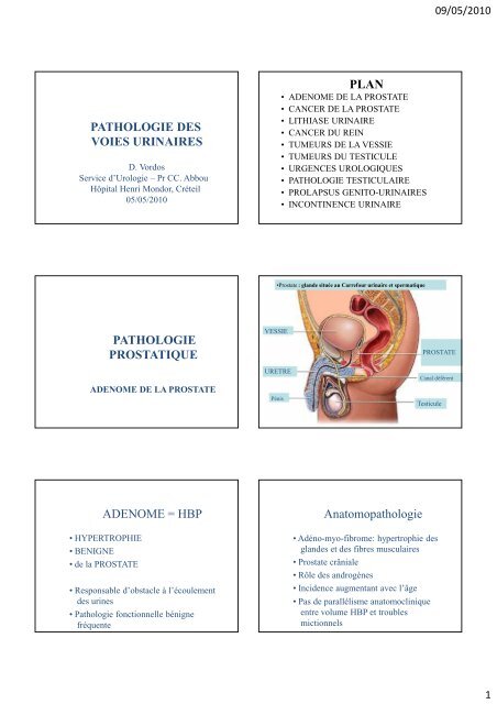 pathologie prostatique