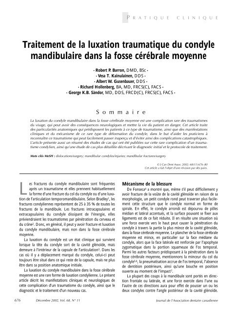 Luxation De La Mandibulaire – Luxation De Mâchoire Réduction – WAUBV