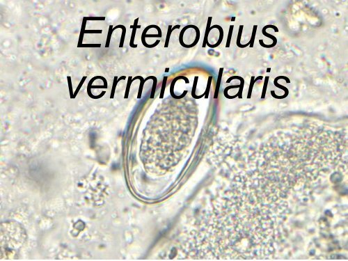 Enterobius Vermicularis Ova