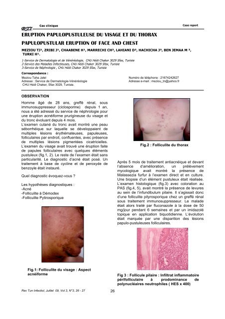 Eruption papulo-pustuleuse du visage et du thorax