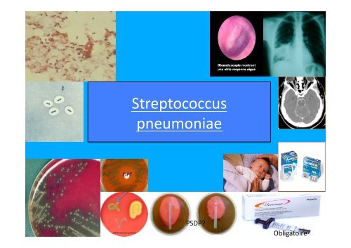 Streptococcus pneumoniae.pptx - PharmaEtudes