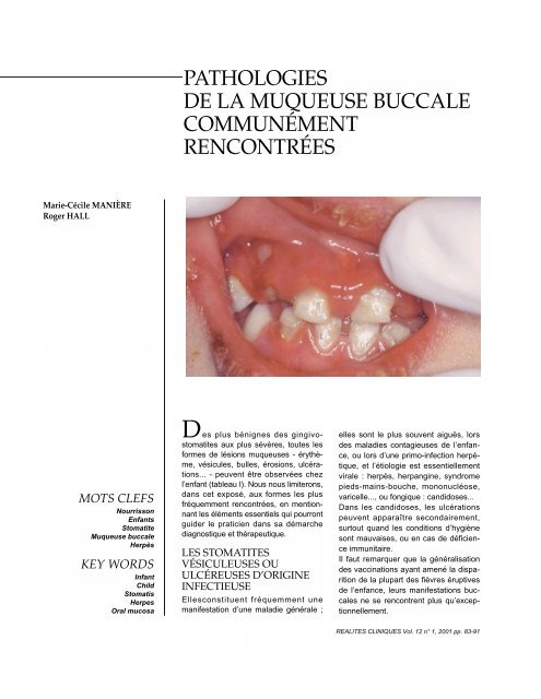 pathologies de la muqueuse buccale communément rencontrées