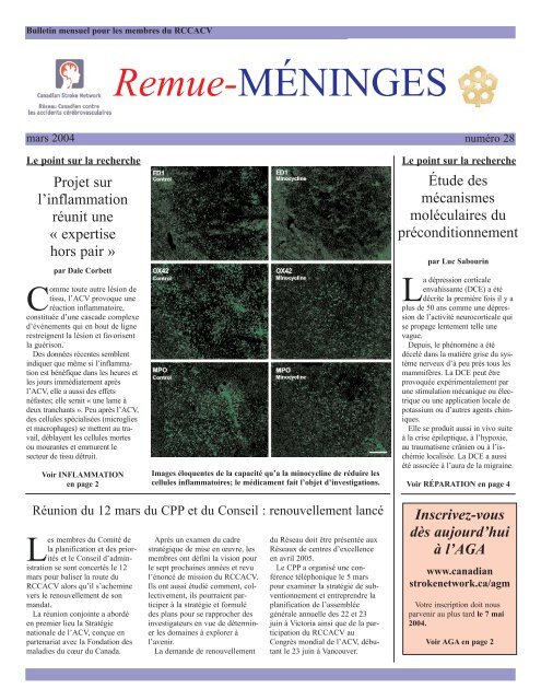 Remue-MÉNINGES - Canadian Stroke Network