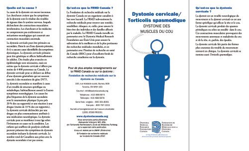 Dystonie cervicale/ Torticolis spasmodique