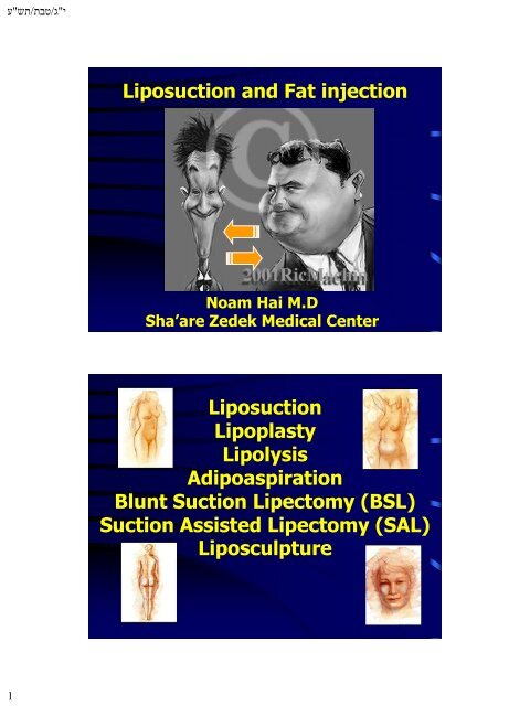 Liposuction and Fat injection Liposuction Lipoplasty Lipolysis ...