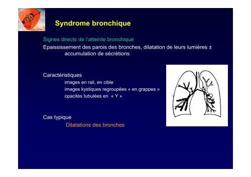 Syndrome bronchique Signe