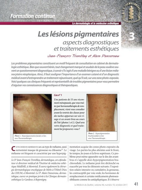 Les lésions pigmentaires : aspects diagnostiques et traitements ...