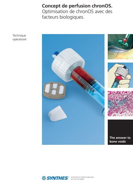 Technique opératoire - Synthes