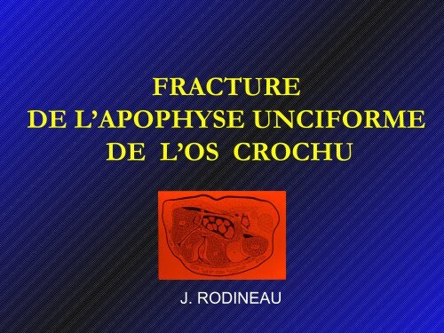 Apofise Cgi De Fractais