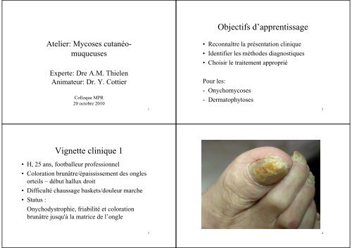 Mycoses muco-cutanées - HUG