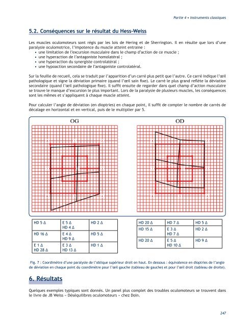 Motricité et sensorialit