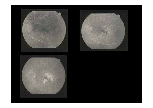 Retinal imaging. From Helmholtz's ophthalmoscope to adaptive optics.