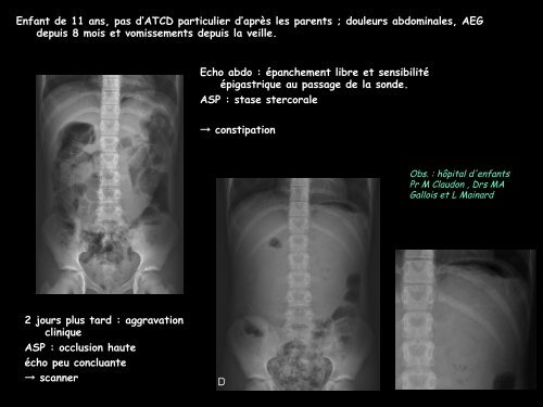 LM CC dig bezoard gastrique - RADIOLOGIE BRABOIS