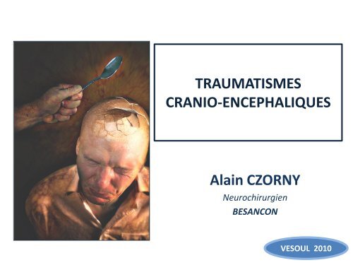 Traumatismes cranio-encéphaliques