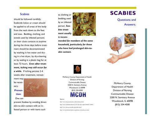 scabies brochure.pdf - McHenry County