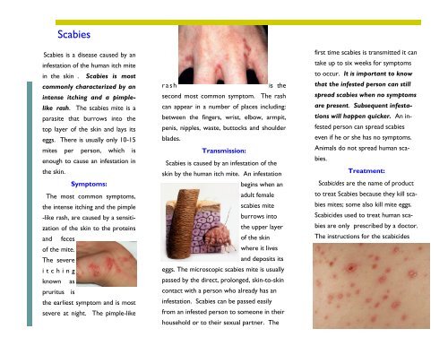 Scabies is a disease caus