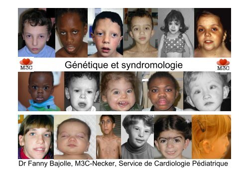 DIU génétique 2012 - Malformations Cardiaques Congénitales ...