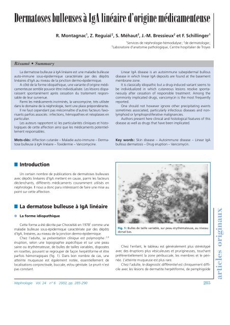 Dermatoses bulleuses à IgA linéaire d'origine médicamenteuse